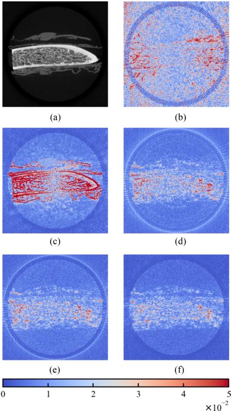 Figure 9 From Artifact Reduction For Sparse View Ct Using Deep Learning