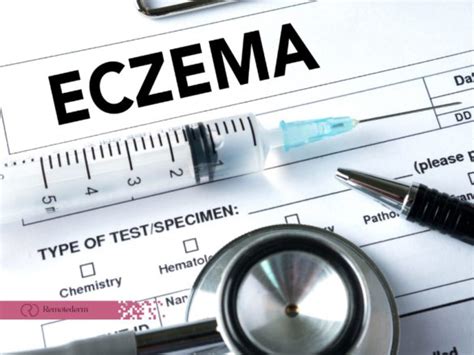 Understanding Asteatotic Eczema Remotederm