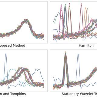 A Qualitative Evaluation Of The Proposed R Peak Detector 3a Presents Download Scientific