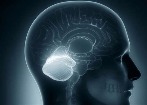Spinocerebellar Ataxia Sukhayu Ayurved Hospital