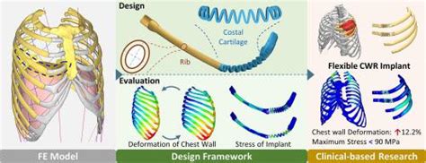 用于恢复呼吸的 3d 打印聚醚醚酮柔性胸壁重建植入物的功能仿生设计 Materials And Design X Mol