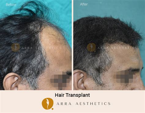 Top 92 Arra Hair Salon And Spa Polarrunningexpeditions