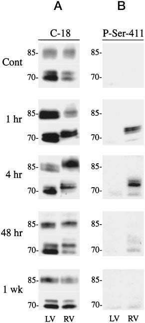 Western Blot Showing The Time Course Of S6k Phosphorylation During