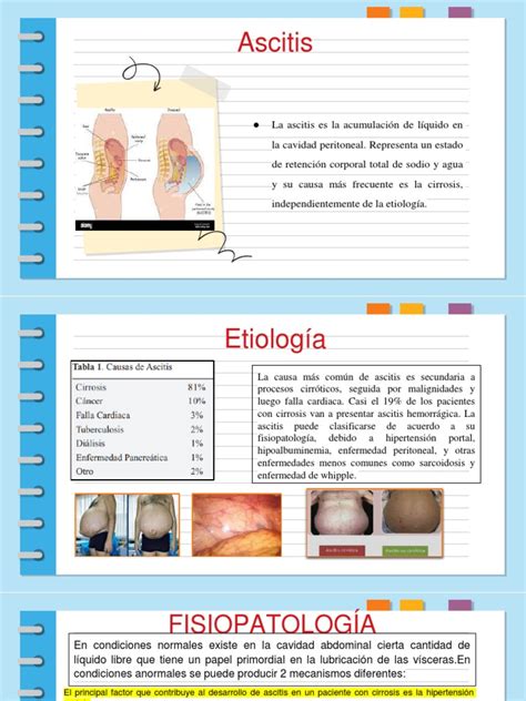 Causas Y Manejo De Ascitis En Cirrosis Pdf Cirrosis Ciencias De