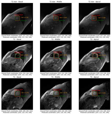Examples Of The Models Output Of A Selected Subject For All Three