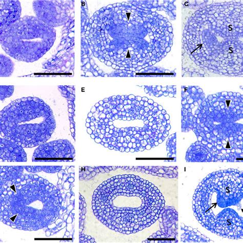 Pdf The Cuc1 And Cuc2 Genes Promote Carpel Margin Meristem Formation