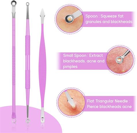 Blackhead Remover Tools 15pcs Pimple Popper Tool Kit Professional Stainless Comedone Pimple
