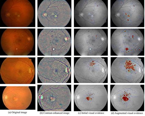 examples of visual evidence generated with guided backpropagation for