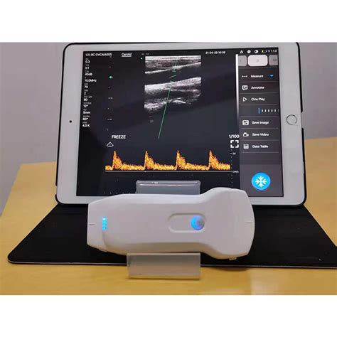 In Linear Convex Double Probes Smartphone Usb Wifi Ultrasound Probe