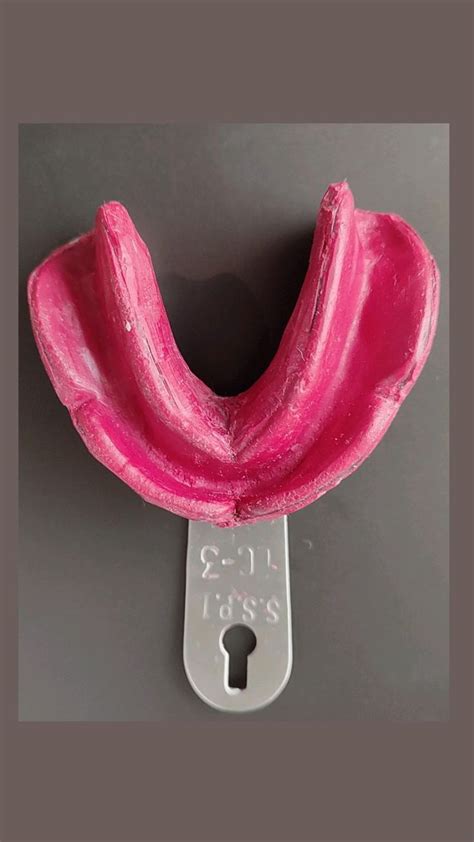 Mandibular Impression Using Impression Compound Impress Save Dental