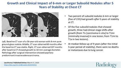 Growth And Clinical Impact Of 6 Mm Or Larger Subsolid Nodules After 5