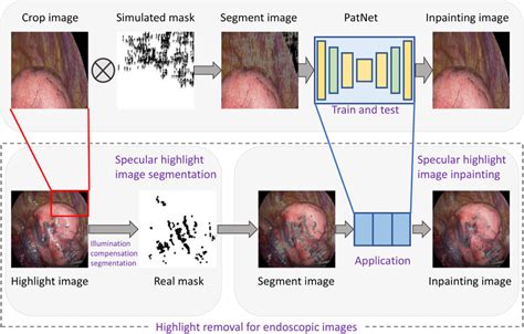 Diagram Of Processing Steps Of Specular Highlight Removal Method In