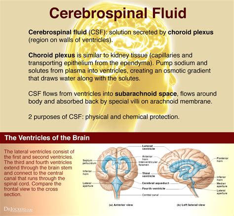 Cerebrospinal Fluid Csf Leak Symptoms Treatment Artofit