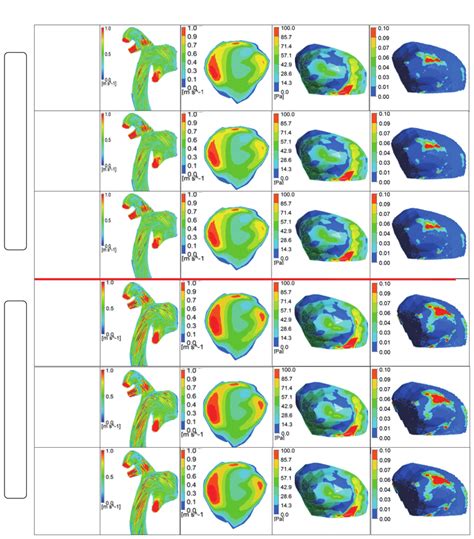 Simulation Results For Hemodynamic Factors Under Different Combinations
