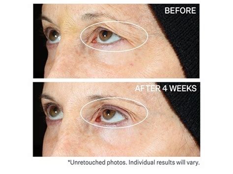 Strivectin Tighten And Lift Peptight™ 360° Tightening Eye Serum Lovelyskin
