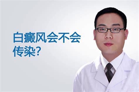 山东济南白癜风医院陈建周医生讲解，白癜风会不会传染凤凰网视频凤凰网