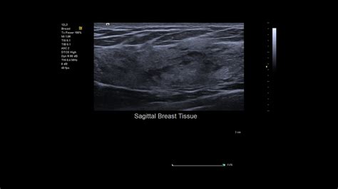 Acuson Juniper Is A High Performance Shared Service Ultrasound System
