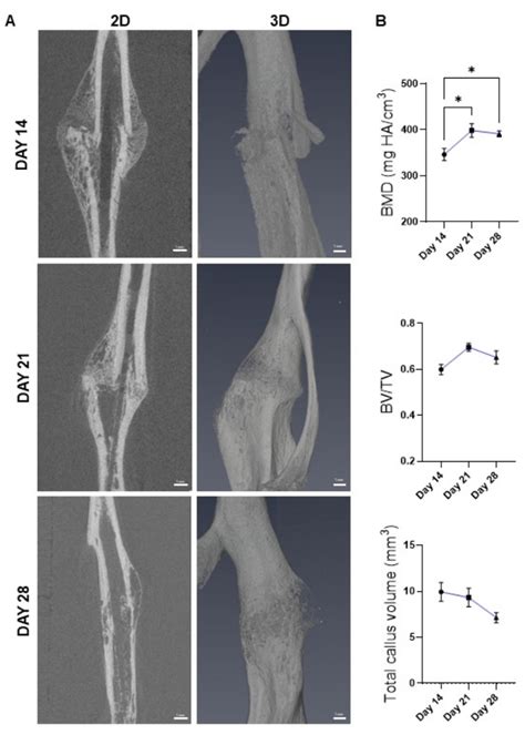 Assessment Of Bone Fracture Healing Using Micro Computed Tomography Protocol