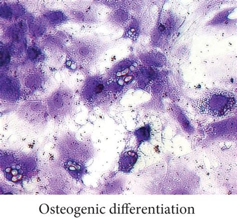 Characterization Of Hucmscs And Hucmsc Evs A Morphology Of Passage 3