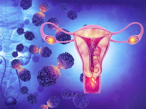 HPV Enfeksiyonu Ve Rahim Ağzı Kanseri Arasındaki İlişki Nedir Prof