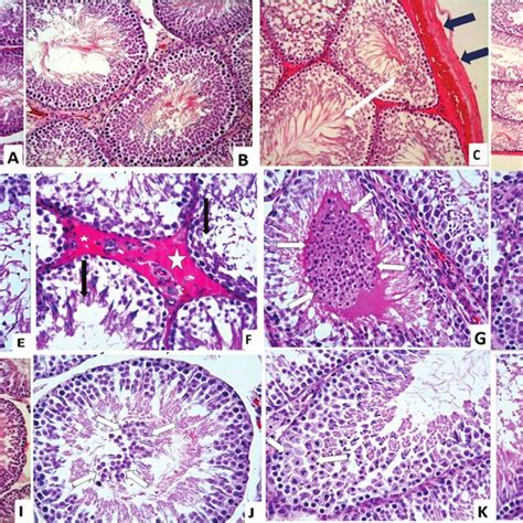 Testis Tissue Showed Normal Histological Appearance In Control A And