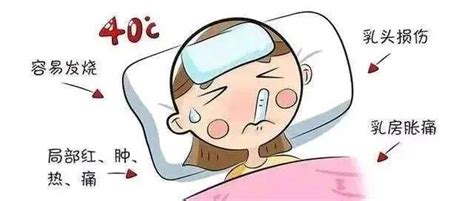哺乳期化脓性乳腺炎乳汁乳房乳头