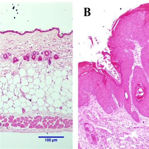 Light Microscopy Of Representative Histological Sections Download