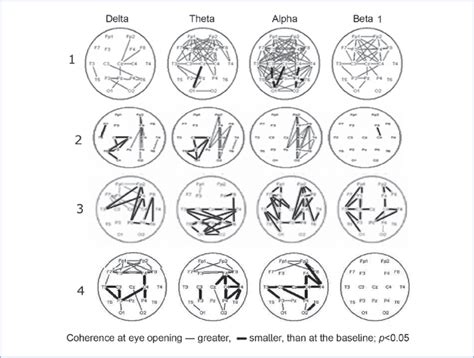 Significant Alterations Of Eeg Coherence According To The Ranges Of