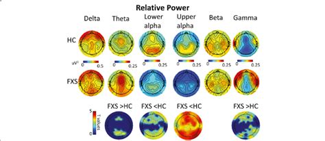 Scalp Topographies Of Relative Power Spectrum For Fxs And Healthy Download Scientific Diagram
