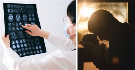 Encephalocele Symptoms Causes Treatment Complications