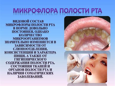 Микрофлора полости рта Микробиология презентация онлайн