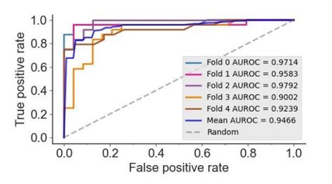 Deep Intelligent Predictive Model For The Identification Of Diabetes