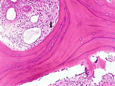 Bone Histology