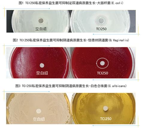 益生菌最懂您的私密私密保养益生菌Lactobacillus johnsonii TCI250 亚健康 新营养 成就食品营养新价值