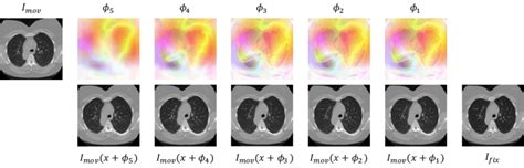 Example Of Rrn Registration On A Pair Of Lung Ct Scans From Dirlab Download Scientific Diagram