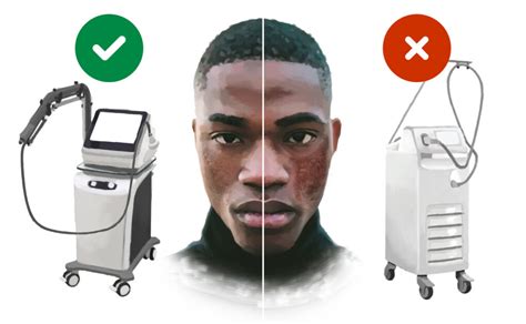 The Best And Worst Lasers For Acne Scar Repair In Dark Skinned People
