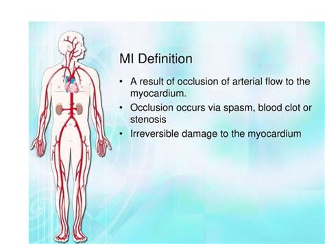 Presentation Myocardialinfarction Finalppt
