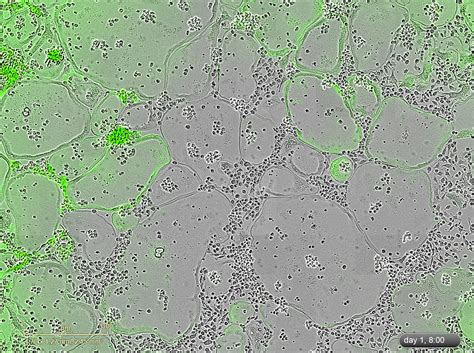 Scipy Counting Number Of Cells And Nucleus Using Watershed Skikit