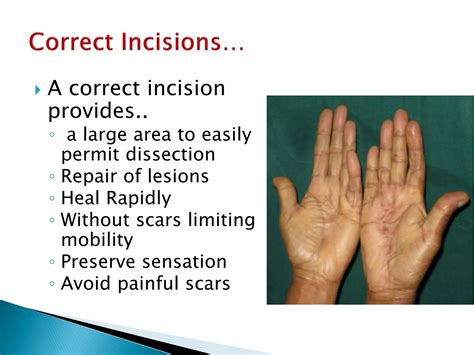 Surgicalincisions 150519180458 Lva1 App6892 Ppt