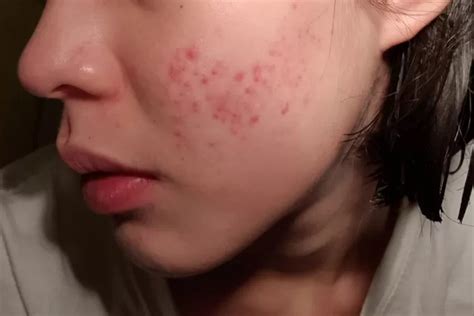 Meminimalisir Kesalahan Saat Pemilihan Produk Skincare Wajib Tahu Perbedaan Pih Dan Pie