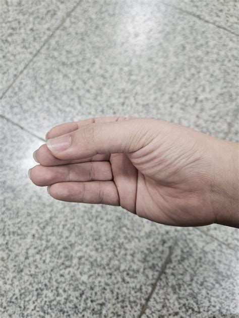 Finger Joint Detection Object Detection Dataset And Pre Trained Model By Sunchul