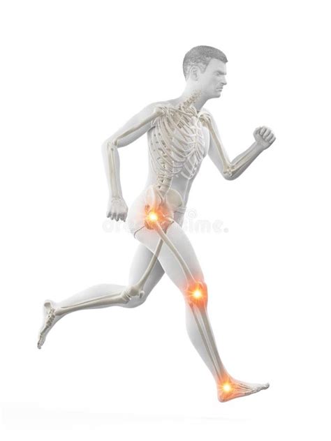 A Runners Painful Joints Stock Illustration Illustration Of Injury
