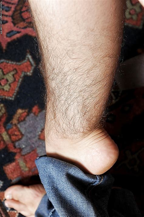 Hairy Leg Tube Telegraph