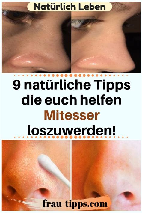 9 Natürliche Tipps Die Euch Helfen Mitesser Loszuwerden Tipps