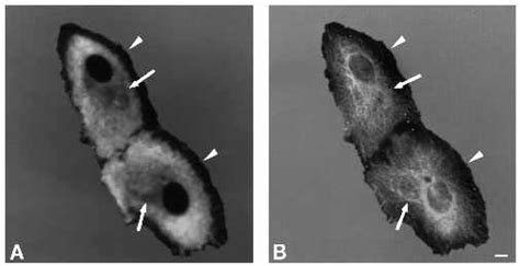 Localization Of Vimentin Filaments With Respect To Excluding Download Scientific Diagram