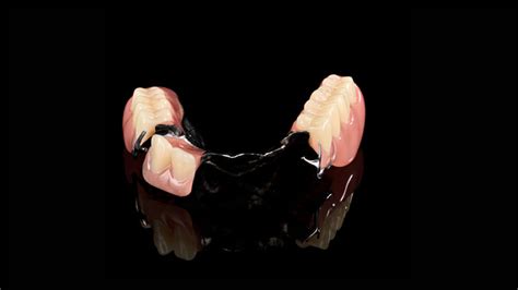 Acrylic Partial Dentures What Do You Need To Know Xdent Lab