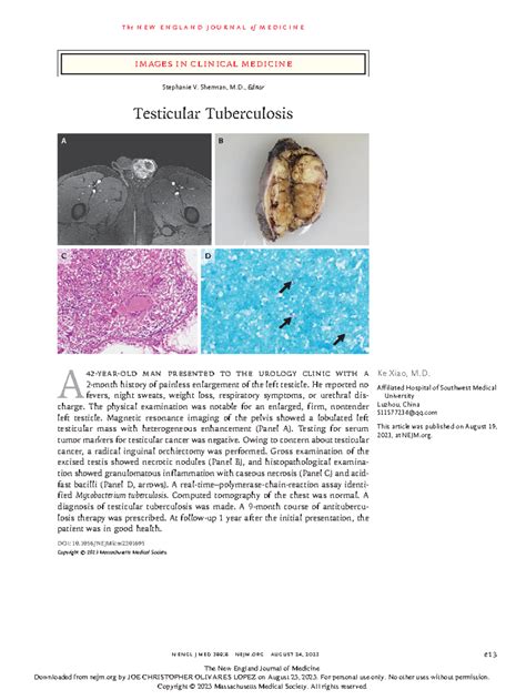 Tuberculosis Testicular T H E N E W E Ng L A N D J O U R Na L O F M E