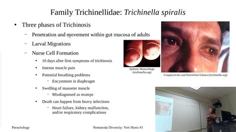 Nematoda Trichinella