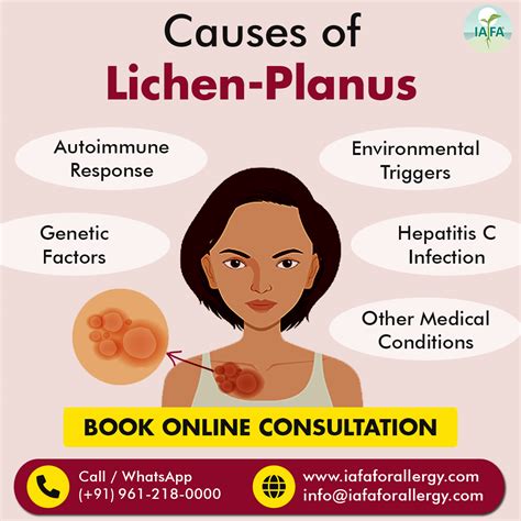 Dr 👉 What Are The Causes Of Lichen Planus Lichen Planus Is A