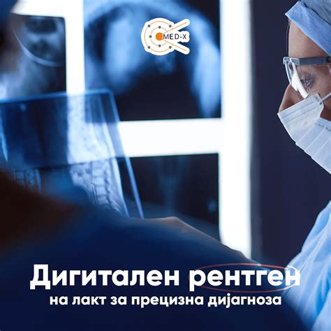 Дигитален рентген на лакт за прецизна дијагноза Мedx